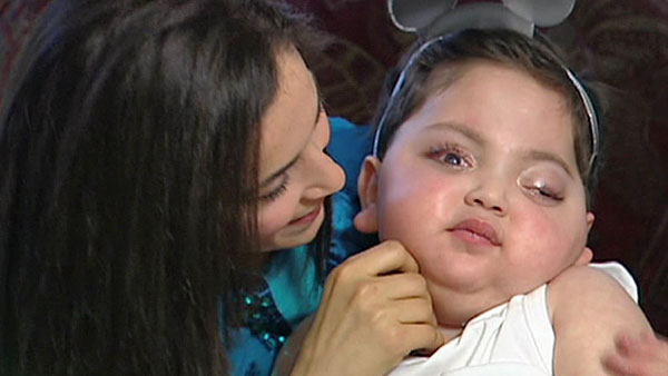 Bittersweet birthday for boy disabled by alleged drunk driver | wfaa.com