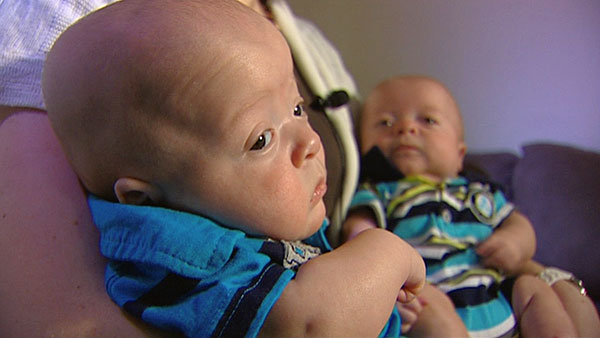 In-womb surgery saves Fort Worth twins | wfaa.com