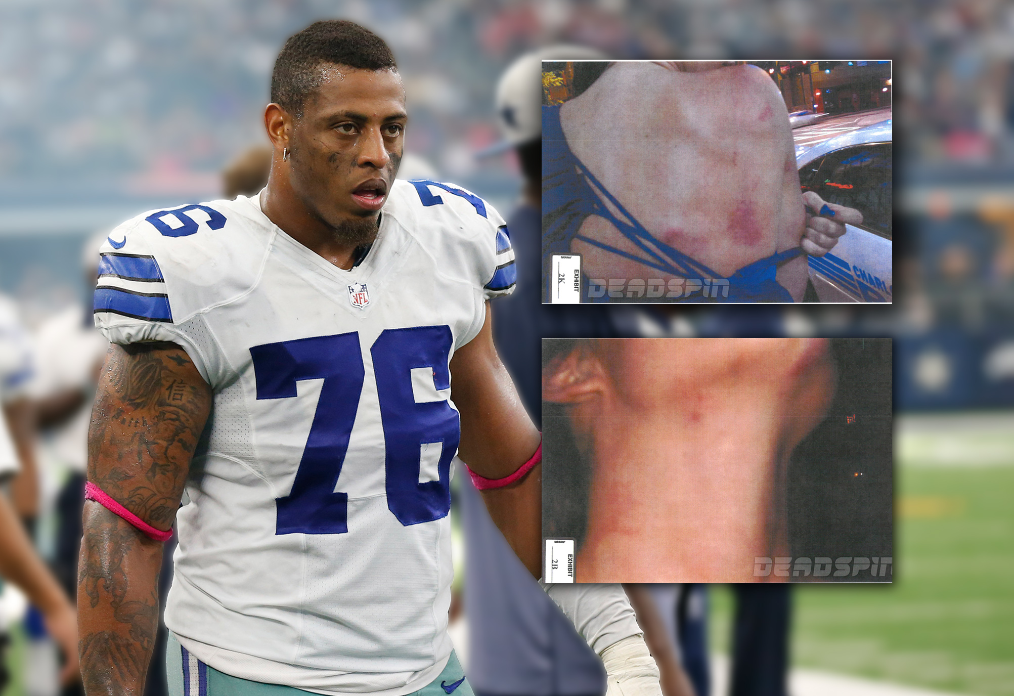 Hansen: Hardy photos won't change Cowboys' minds | wfaa.com