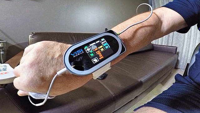A 'smart watch' for hospital patients | WFAA.com